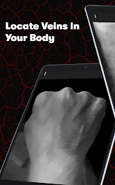 X-Vein App - Reviewed